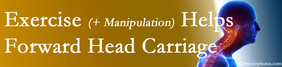Richmond Chiropractic Care of Forward Head Carriage | Johnson Chiropractic